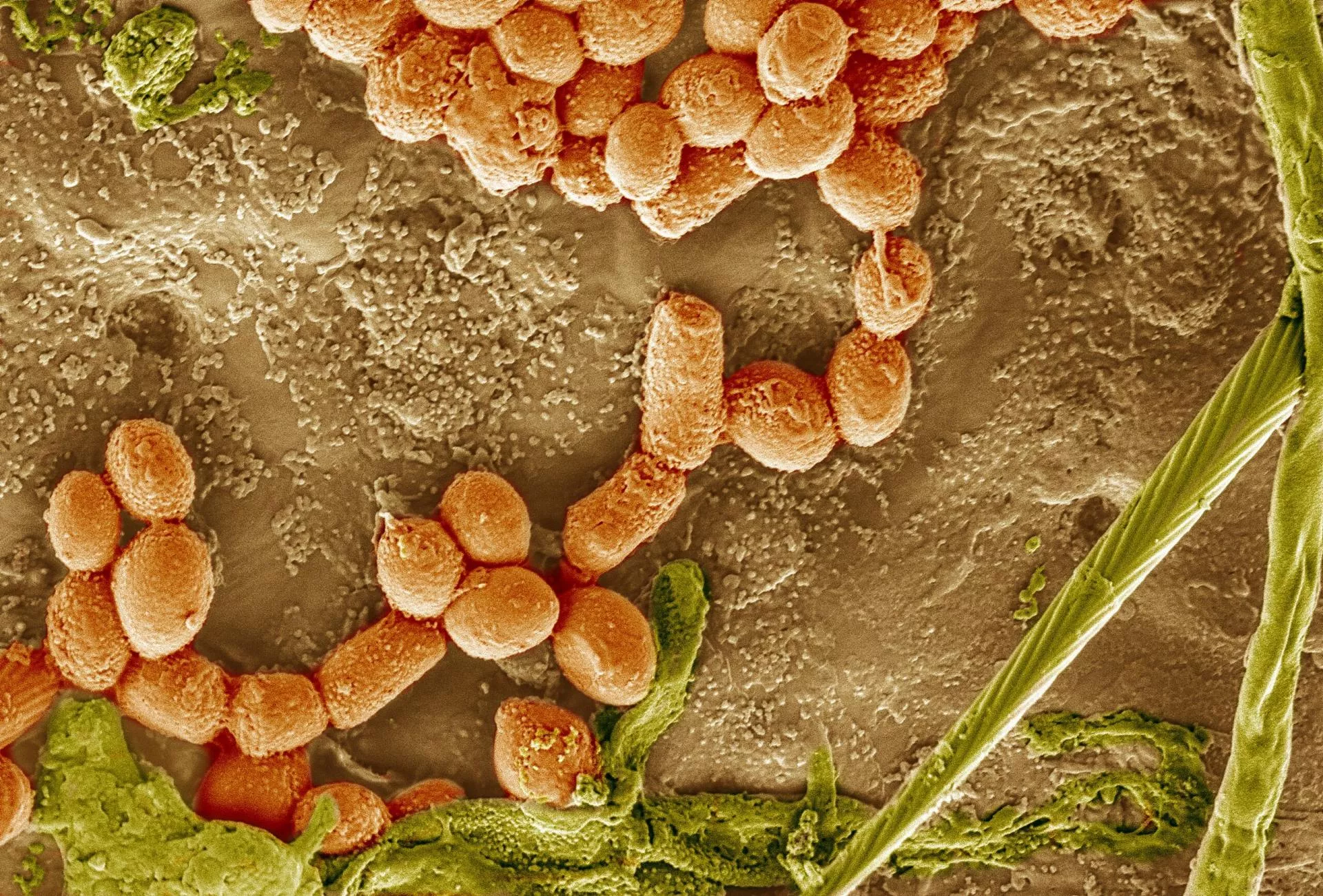 Spore.Bio pozyskuje 23 mln dolarów na rozwój technologii szybkiego ...